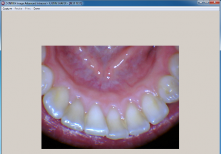 Intraoral Camera Software for Dentrix Image - IOC Snapshot