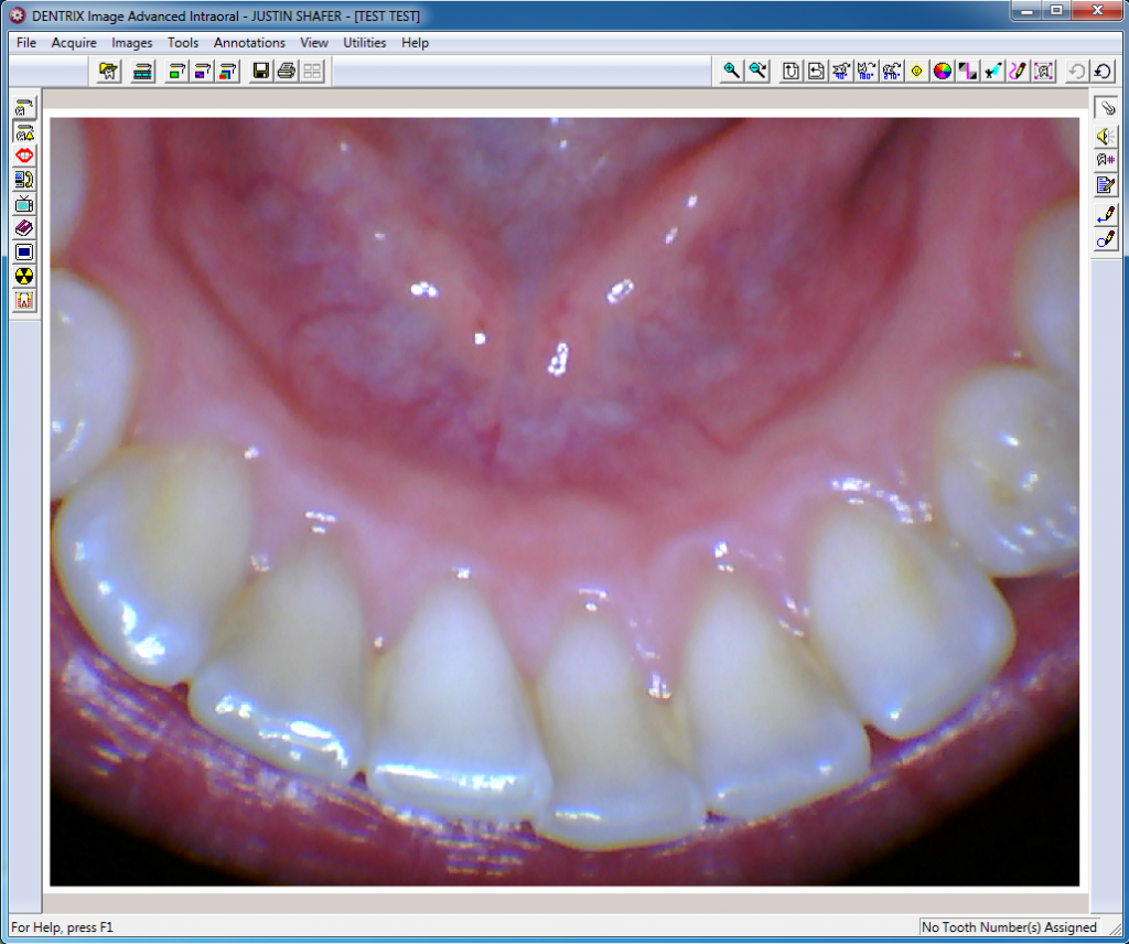 Dentrix Image | IOC Snapshot