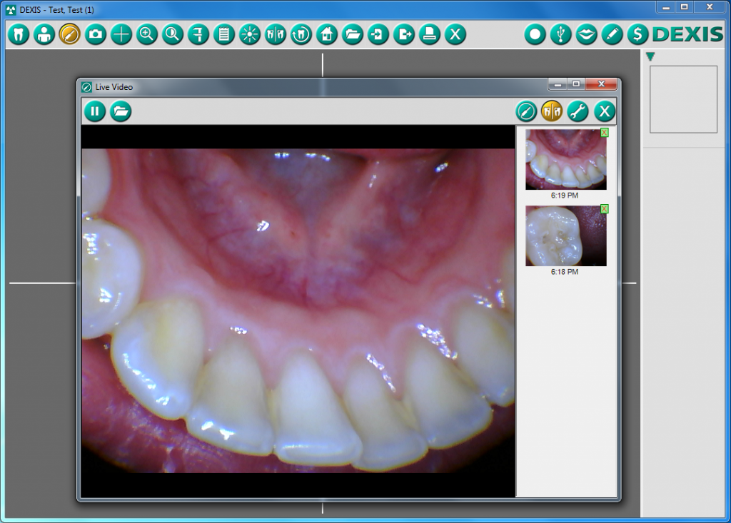 Dexis 10 & 11 - IOC Snapshot