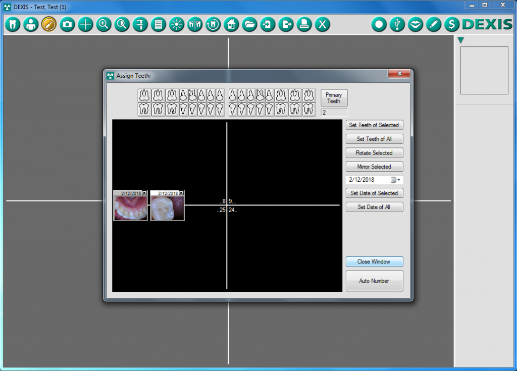 Dexis 10 & 11 - IOC Snapshot
