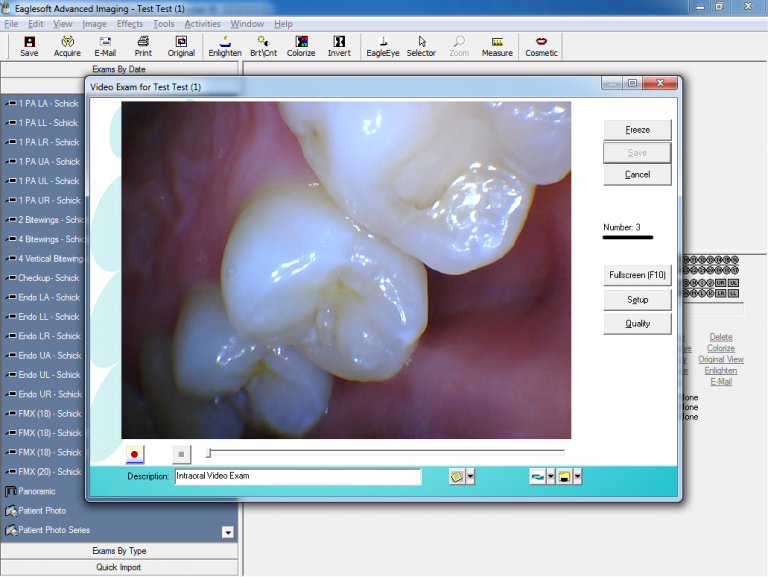 Eaglesoft - IOC Snapshot