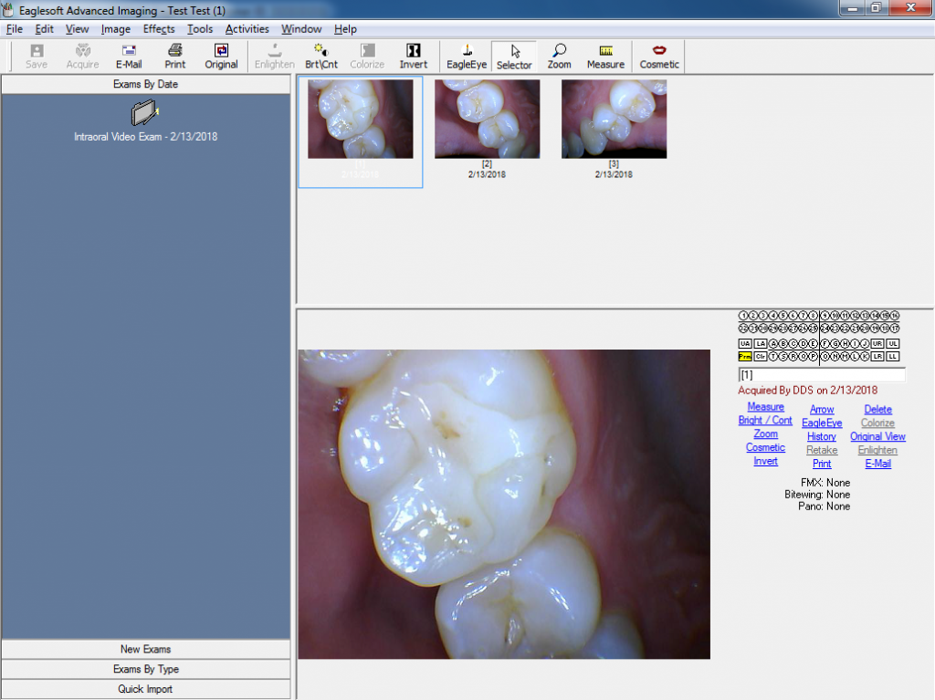 Eaglesoft - IOC Snapshot