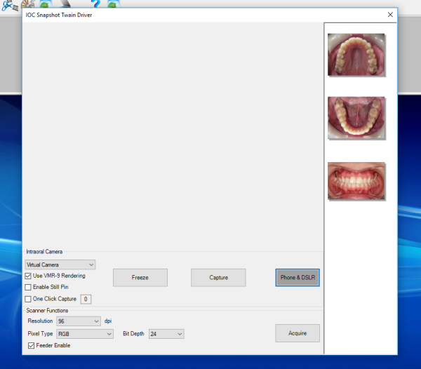 Sopro Imaging - IOC Snapshot