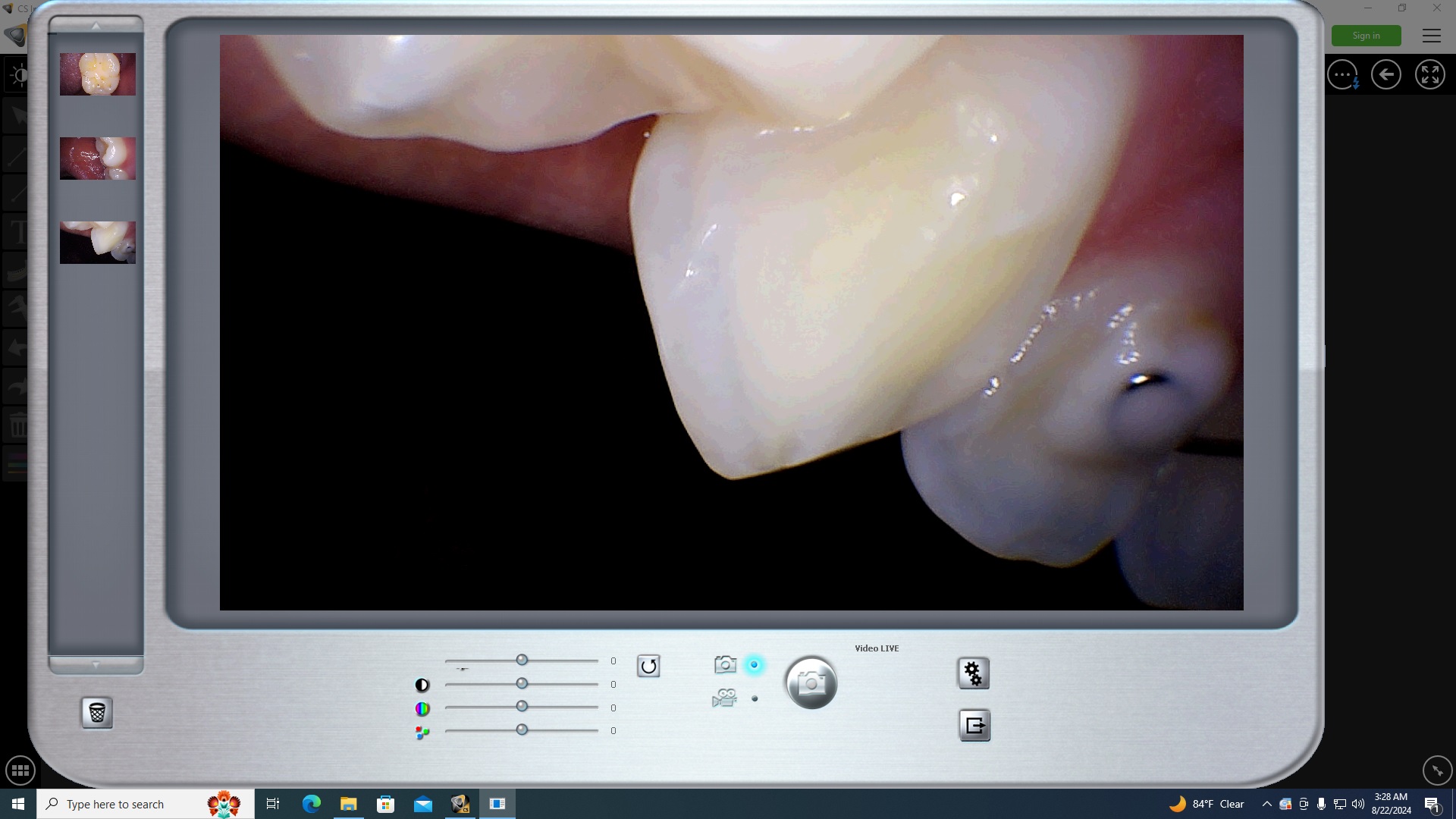 Perfect Cam Manual for Carestream Imaging 8 - IOC Snapshot