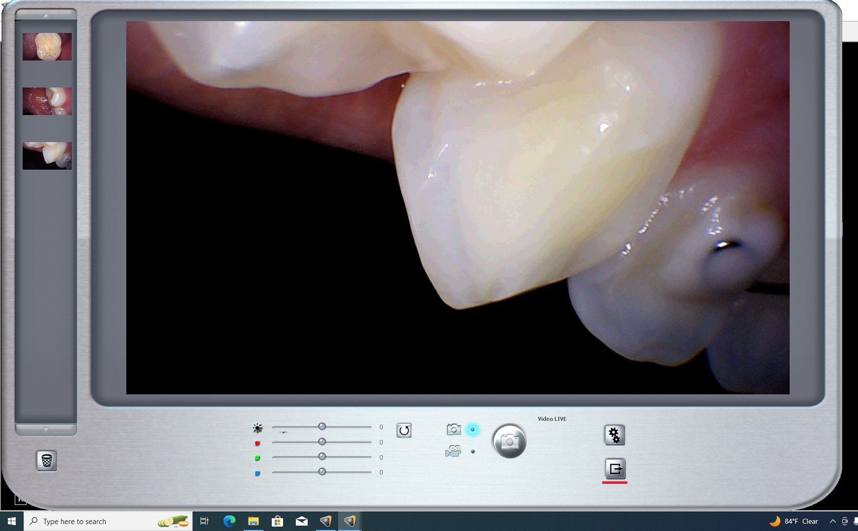 Perfect Cam Manual for Carestream Imaging 6 & 7 - IOC Snapshot