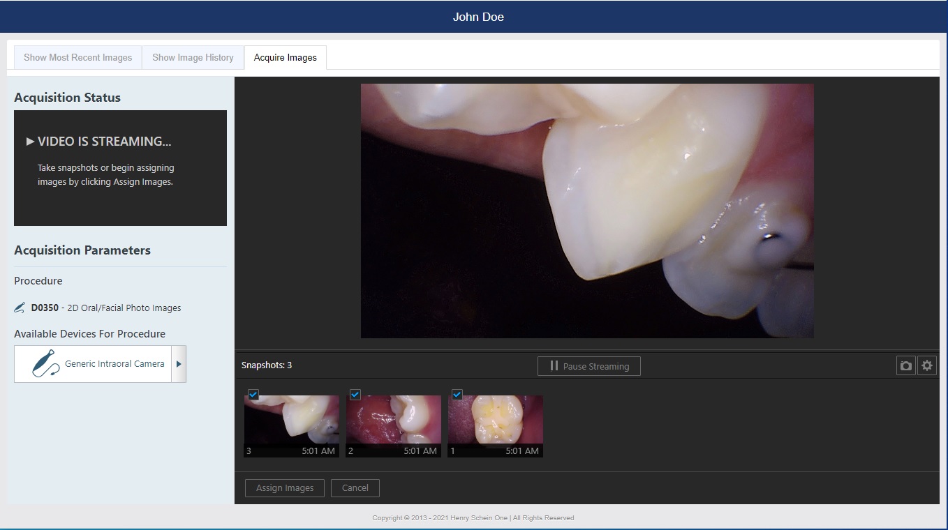 Perfect Cam Manual for Dentrix Imaging Center - IOC Snapshot