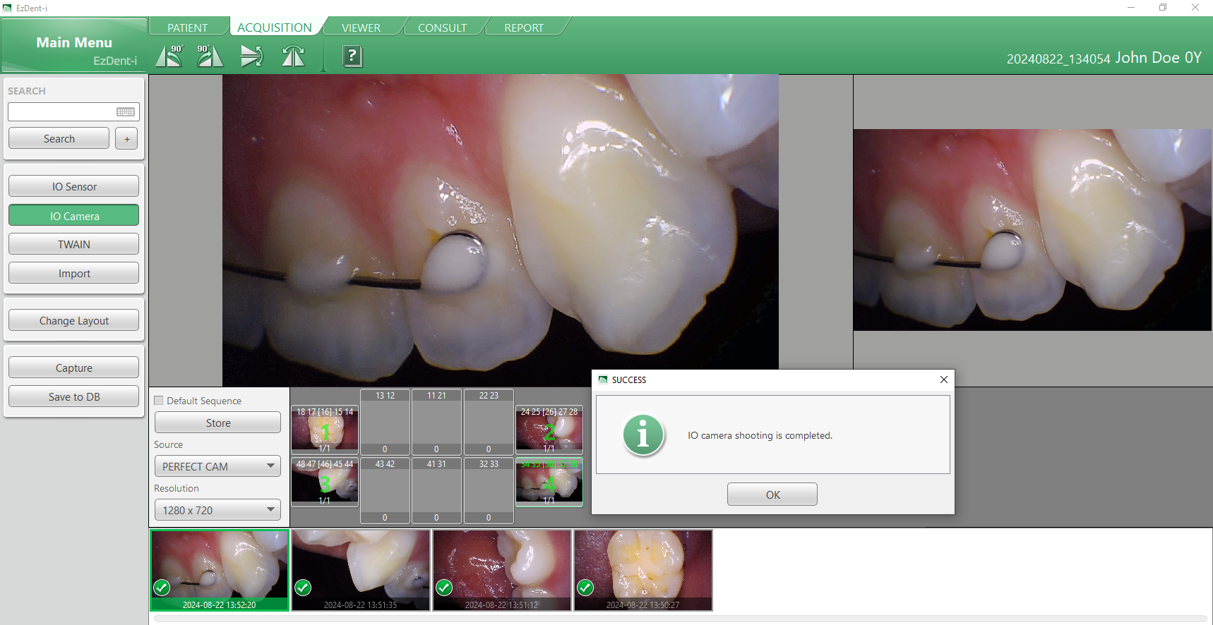 Perfect Cam Manual for Vatech EZDent-i - IOC Snapshot